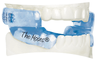 Oral Sleep Appliance Weatherford | Custom Oral Appliance | OSA Treatment